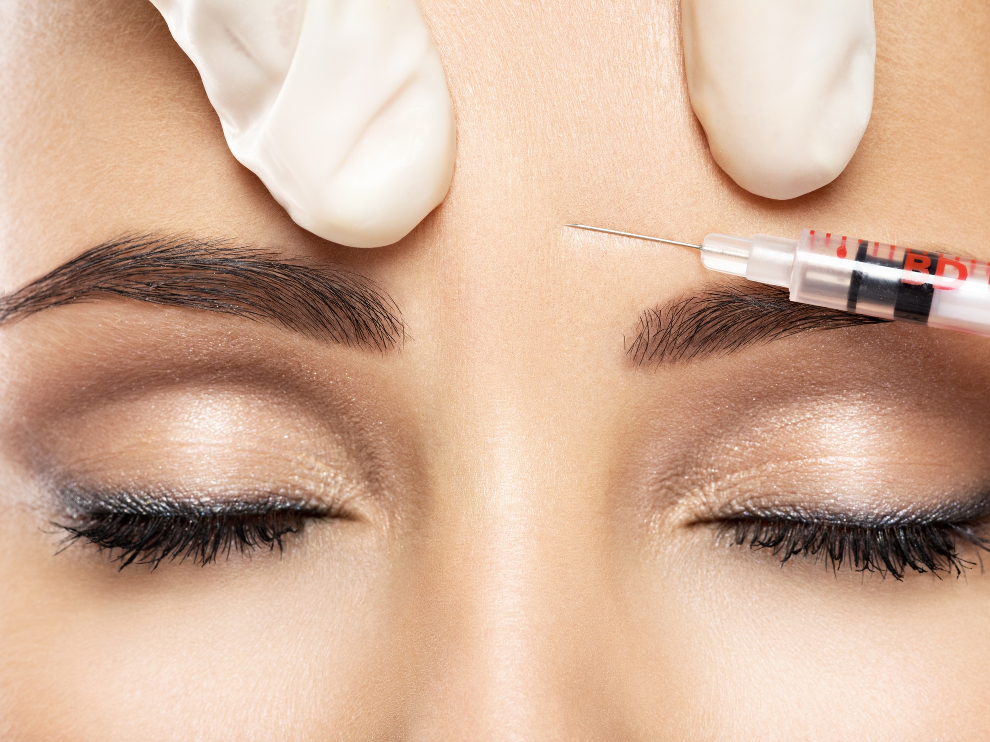 Botox in Redlands, CA | Hushh Medical Aesthetics